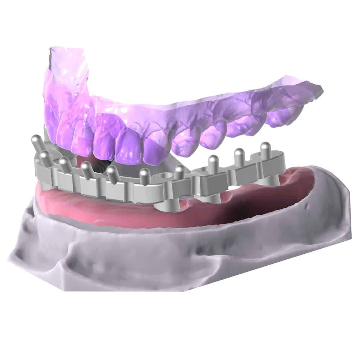 - exocad Ultimate Lab Bundle - Flex/Perpetual license - Bristol CadCam