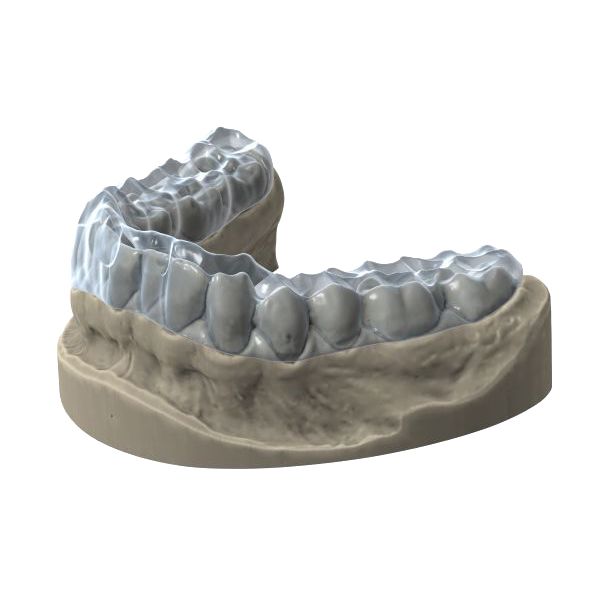 exocad bite splint module - Bristol CadCam