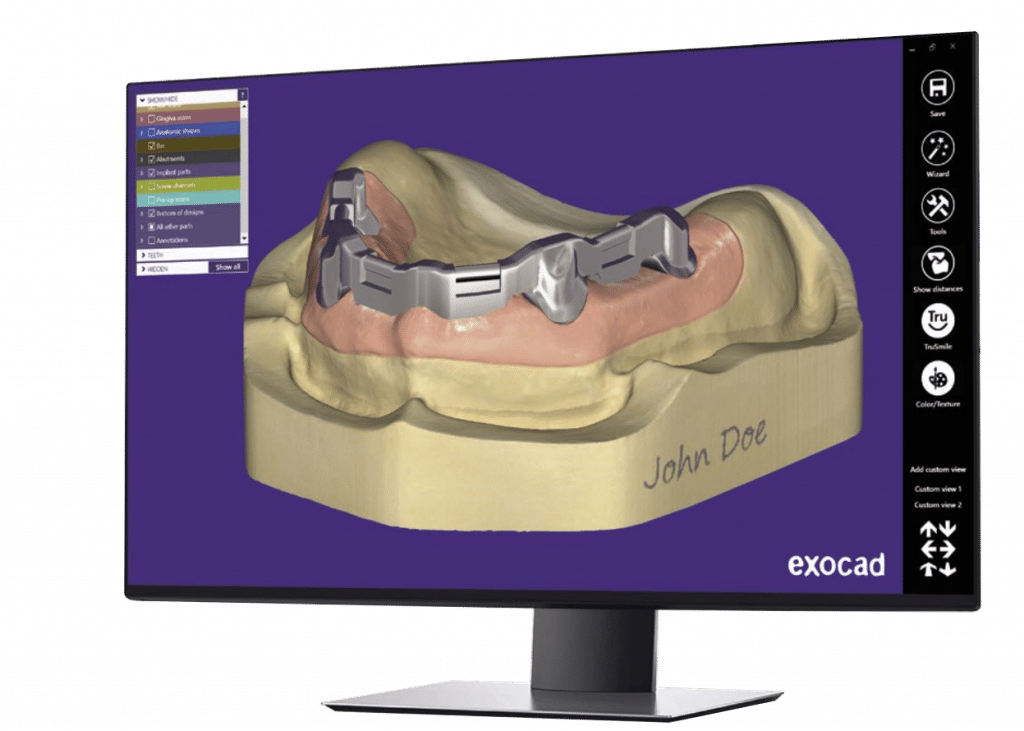 - exocad Implant Lab Bundle - Flex/Perpetual license - Bristol CadCam