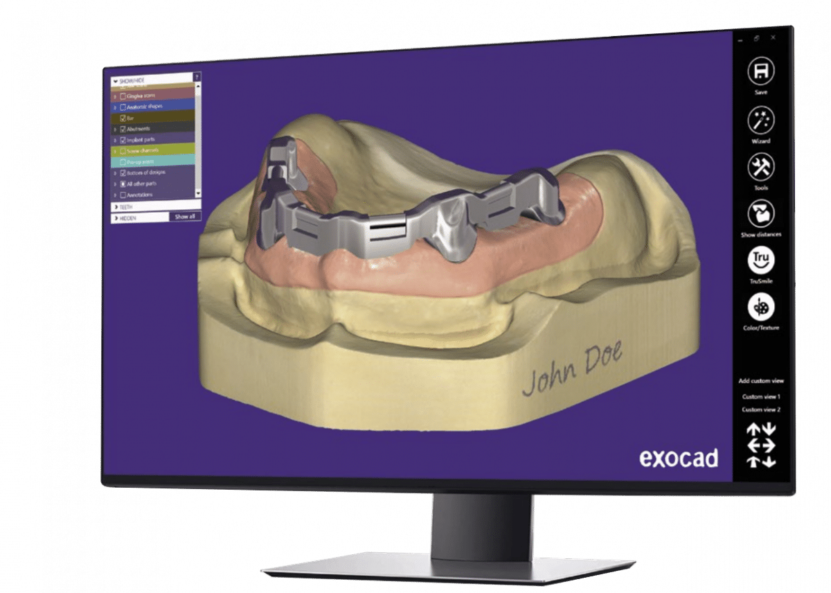 - exocad Implant Lab Bundle - Flex/Perpetual license - Bristol CadCam