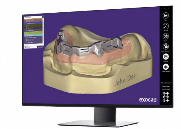 EXOCAD Dynamic Price Comparison - Bristol CadCam