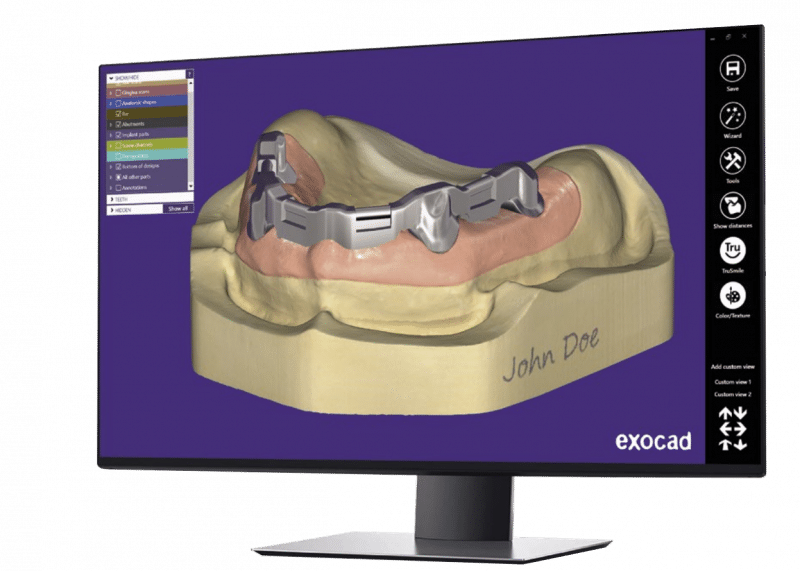 EXOCAD Dynamic Price Comparison - Bristol CadCam