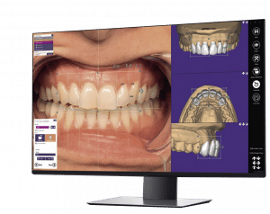 EXOCAD Dynamic Price Comparison - Bristol CadCam