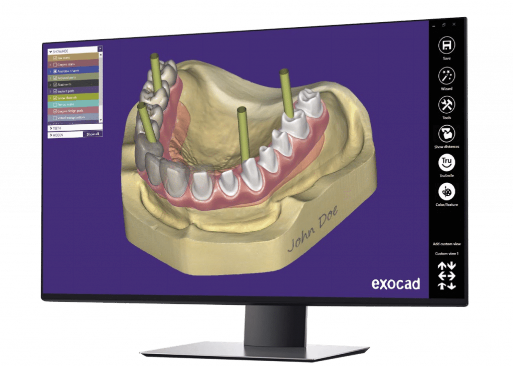 EXOCAD Dynamic Price Comparison - Bristol CadCam