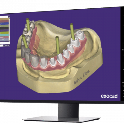 exocad tooth library ZRS module - Bristol CadCam