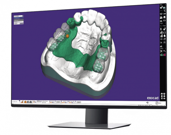 EXOCAD Dynamic Price Comparison - Bristol CadCam
